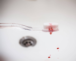 HK Dentists’ Best Guide on Dental Procedures